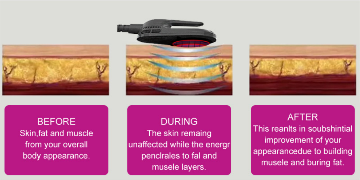 Ems RF Body Sculpting Machine from China Manufacturer - Beauty machine ...