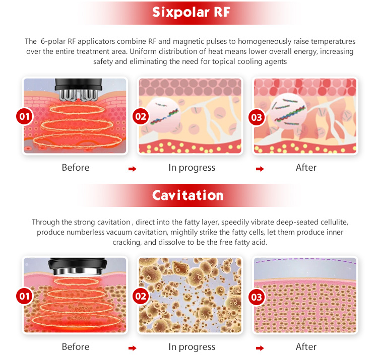 Vacuum 40k Cavitation System Ultrasonic Liposuction Fat Lipo Therapy ...